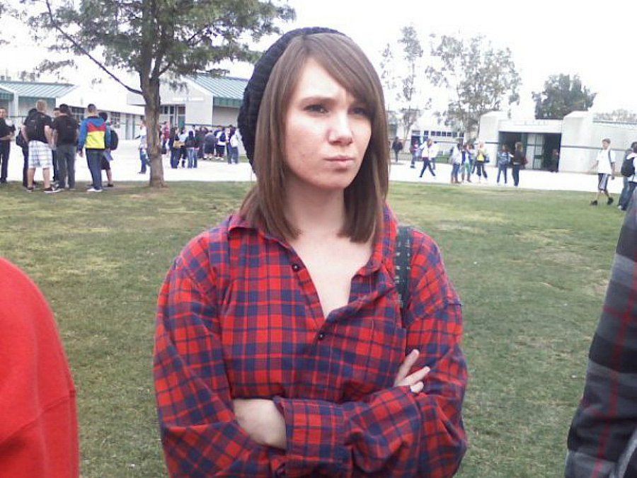 The Struggles I Experienced With Years of Acne